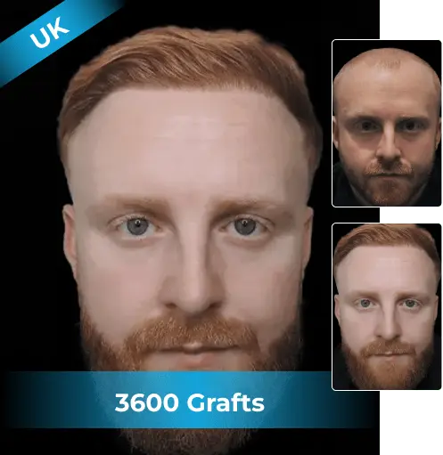 TitanHair Landing Page - TitanHair